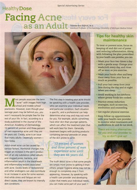 Acne Treatment Ad 8 “facing Acne As An Adult”