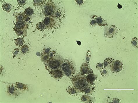 Someone Expert In Trap Assay Can Help Me To Recognize Osteoclast On