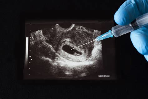 Medicut Images – Browse 46 Stock Photos, Vectors, and Video | Adobe Stock