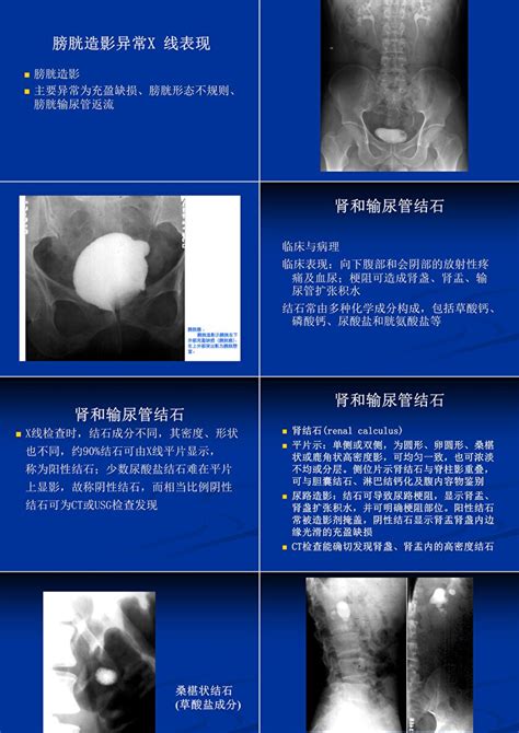 泌尿系造影影像诊断ppt模板卡卡办公