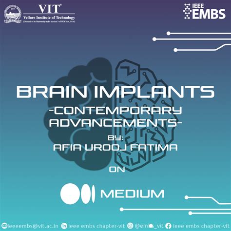 Brain Implants Virtual Reality In The Field Of Gaming Technological