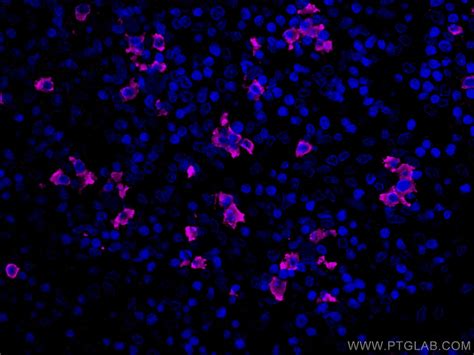 Human Ig Lambda Chain Antibody Cl647 67762 Proteintech