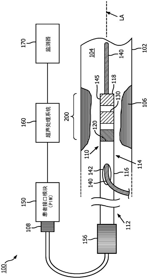 Frequency Tunable Intraluminal Ultrasound Device Eureka Patsnap
