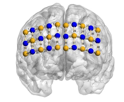 Localization Of Regions Of Interest Note Ventrolateral Prefrontal Download Scientific Diagram