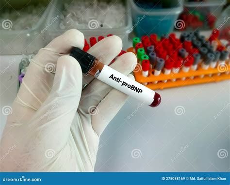 N Terminal Pro B Type Natriuretic Peptide Or Nt Probnp Test Cardiac