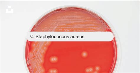 Staphylococcus Aureus Fotos Baixe Imagens Gratuitas Na Unsplash