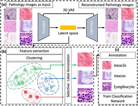 An Overview Of Our Eposa Framework Using Pathology As An Example A Download Scientific