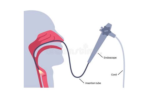 Procedure Visualization Stock Illustrations 1 425 Procedure