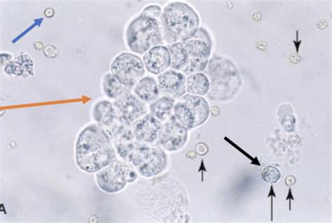 Clin Path Microscopic Identification Flashcards Quizlet
