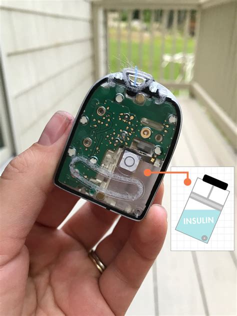 How To Pull Insulin Out Of Omnipod Don T Waste A Drop