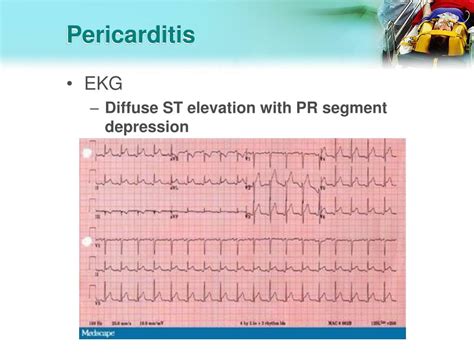 Ppt Cardiac Emergencies What Is My Role Powerpoint Presentation