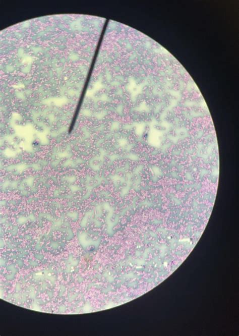 Capsule Stain Rmicrobiology