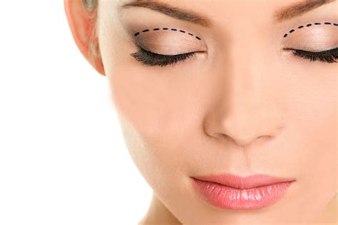 Cirugía De Parpados Blefaroplastia Dr Jaime Ramírez