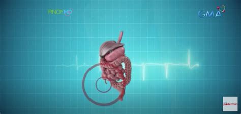 What Is Gangrenous Appendicitis Gma News Online