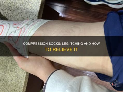 Compression Socks Leg Itching And How To Relieve It Shunvogue