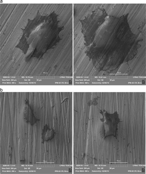 Scanning Electron Microscopy Sem Analysis Of The Human Umbilical Vein