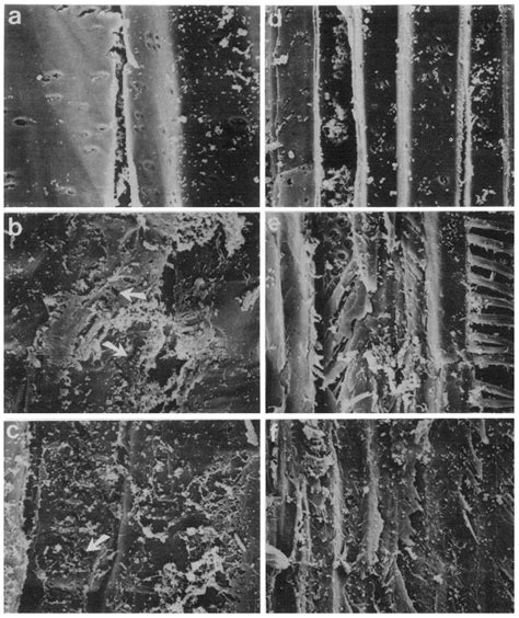 Scanning Electron Micrographs Of Alfalfa Stem Cell Walls Incubated In