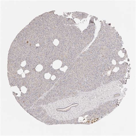 tissue expression of cep120 staining in pancreas the human protein