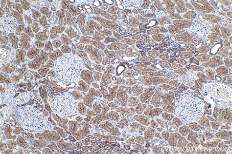 Ihceasy Nfe2l2 Nrf2 Ready To Use Ihc Kit Khc1065 Proteintech