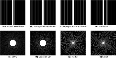 On Retrospective K Space Subsampling Schemes For Deep Mri Reconstruction Paper And Code Catalyzex