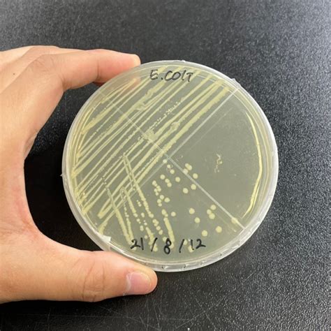 균 배양 순수배양획선접종streaking 네이버 블로그