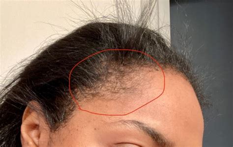 Regrow Edges On Natural Hair FAST Product Review