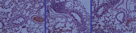 Lungs Of The Ova Induced Asthma Il10 Shrna Interference Rats Few