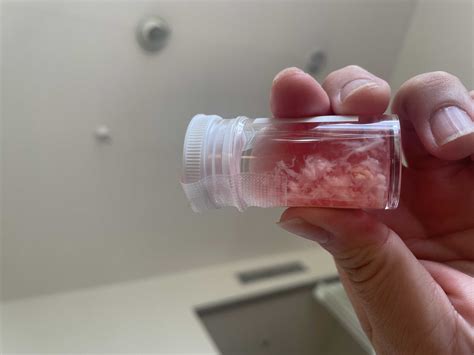 腰椎椎間板ヘルニア の手術をした話11 コミュ障ママのファンタジーな日々のこと 楽天ブログ