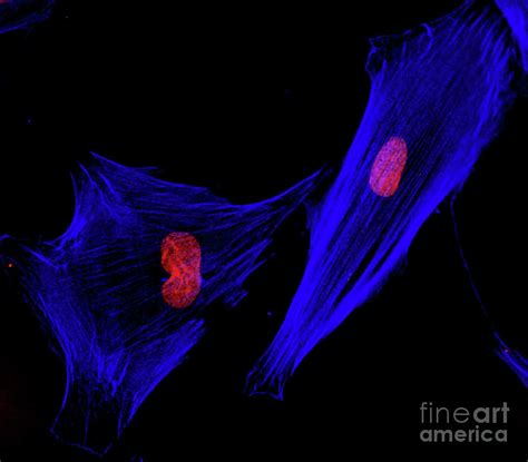 Human Fibroblast Cells Photograph By Science Photo Library Pixels Merch