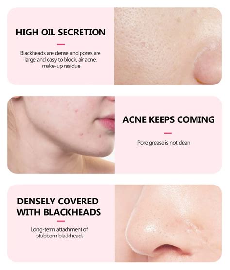 Badu Bg Система за почистване със силиконов гел Ултразвукова