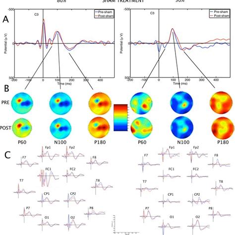 Effects Of Cerebellar Ctbs Itbs And Sham Tms On The Resting Motor