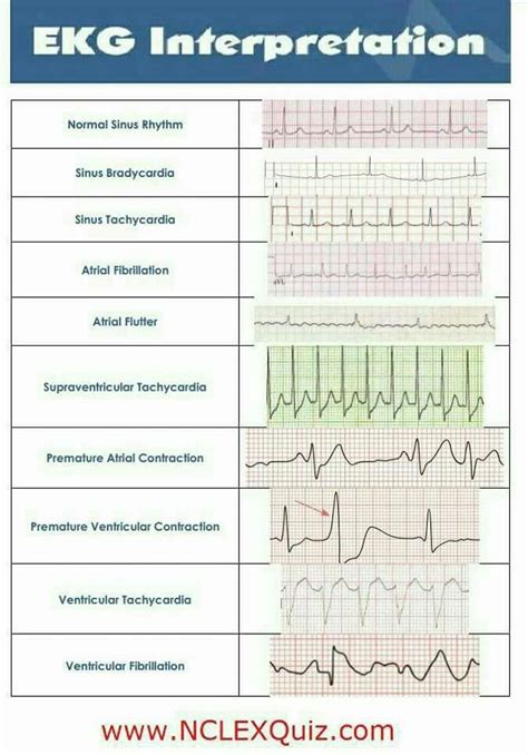 Pin By Carli Gibbs On Ekg Cardiac Nursing Critical Care Nursing Nurse