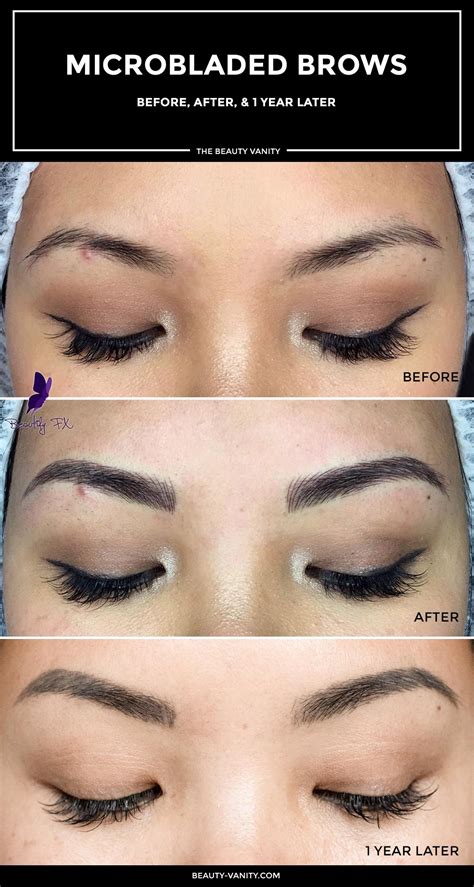Asian Microbladed Brows Before After And 1 Year Later The Beauty Vanity Asianbrows