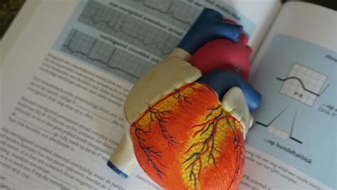 How Is Atrial Flutter Treated Heres What You Need To Know