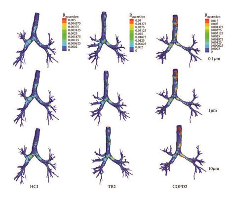 The Particle Deposition Patterns Presented By Dpm Accretion Rate In Download Scientific Diagram
