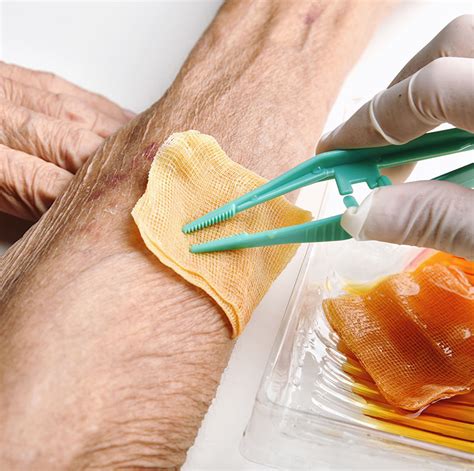 Wound Management Prima Vita Clinic