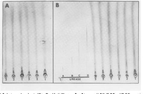 Figure 1 From A Soybean Seed Urease Null Produces Urease In Cell