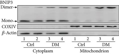 Activation Of Hif 1α Pathway In Sertoli Cells Of Diabetic Mice A
