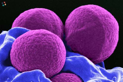 Methicillin Resistant Staphylococcus Aureus Mrsa Overview Antibiotics Impact And Spread The