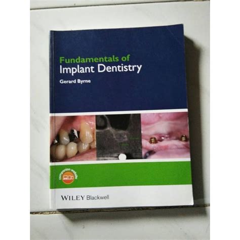 Jual Fundamentals Of Implant Dentistry Shopee Indonesia