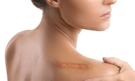 Integrated Dermatology Of Montrose Dermatology And Mohs Surgery
