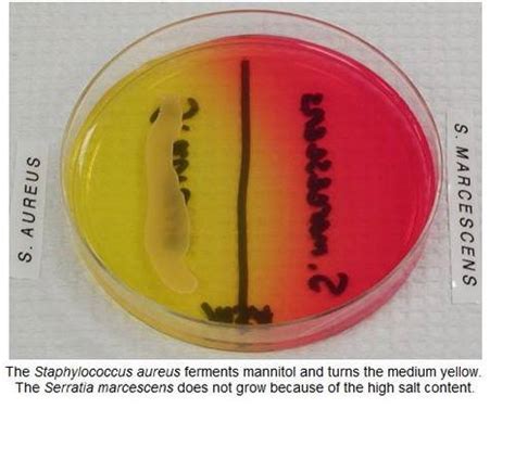 Staphylococcus Mannitol Salt Agar Plate Medical Laboratories