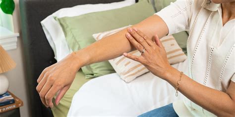 How To Treat Bug Bites According To Doctors