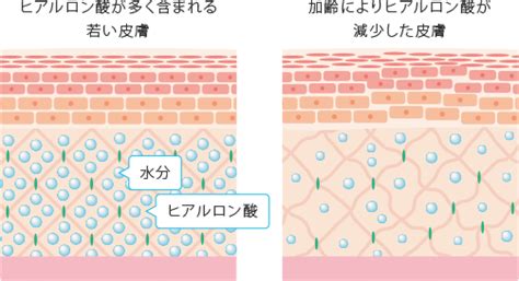 ヒアルロン酸注射（注入）の効果と値段｜美容皮膚科 銀座よしえクリニック【公式】東京