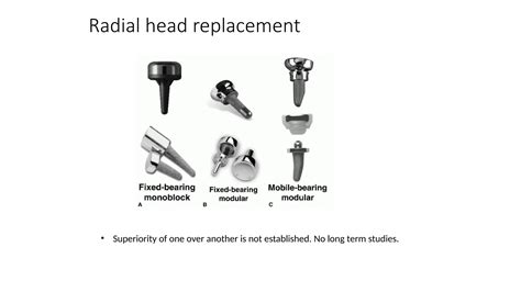 Elbow Dislocation With Radial Head Fracture Pptx