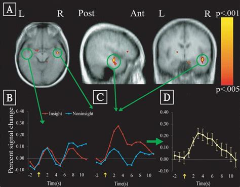 Modular Brain Theory Lunarpedia