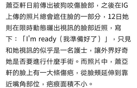 蕭亞軒被狗咬後曬傷疤，大面積縫針好嚇人，臉細胞壞死曾一度厭世 每日頭條