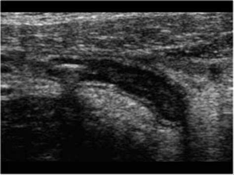 Pediatrics 91 Pediatric Abdomen And Retroperitoneum Case 917
