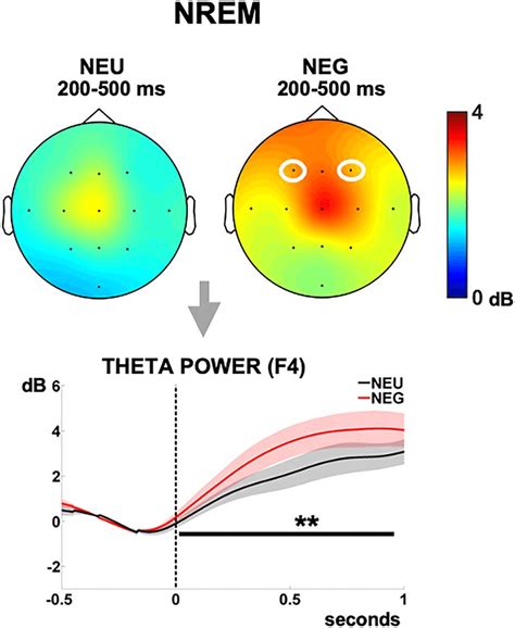 Theta Oscillations 4 8 Hz During Nrem Top Scalp Distribution Plots Download Scientific