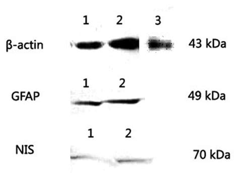 Western Blot Analysis 1 U251 Cell Line 2 U87 Cell Line 3 Mrc 5
